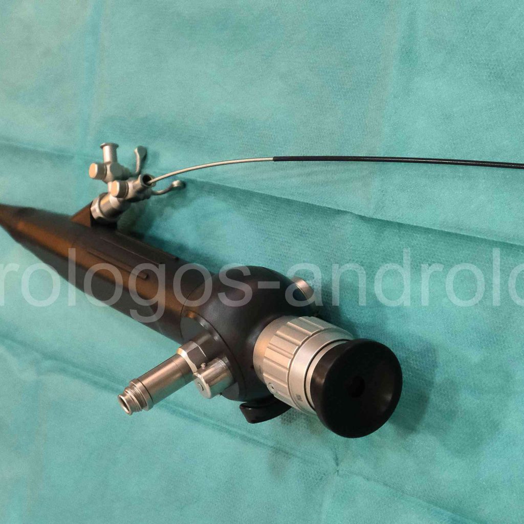 Ουρολόγοι Θεσσαλονίκη: cysteoscopy_flex1a5